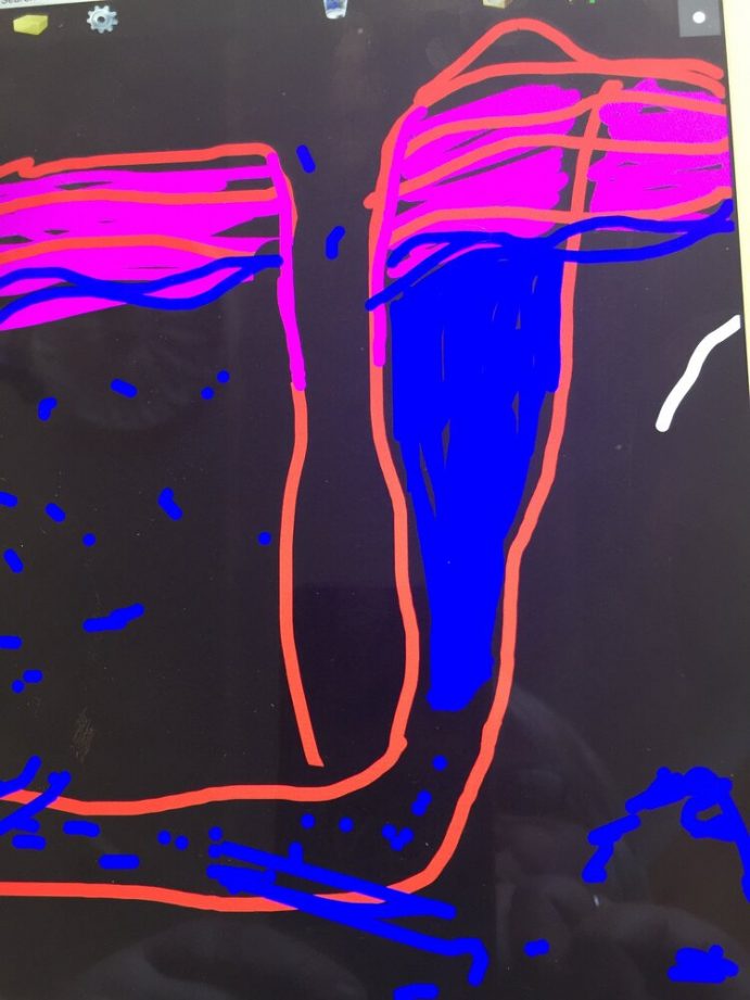 Therapeutic Drawing